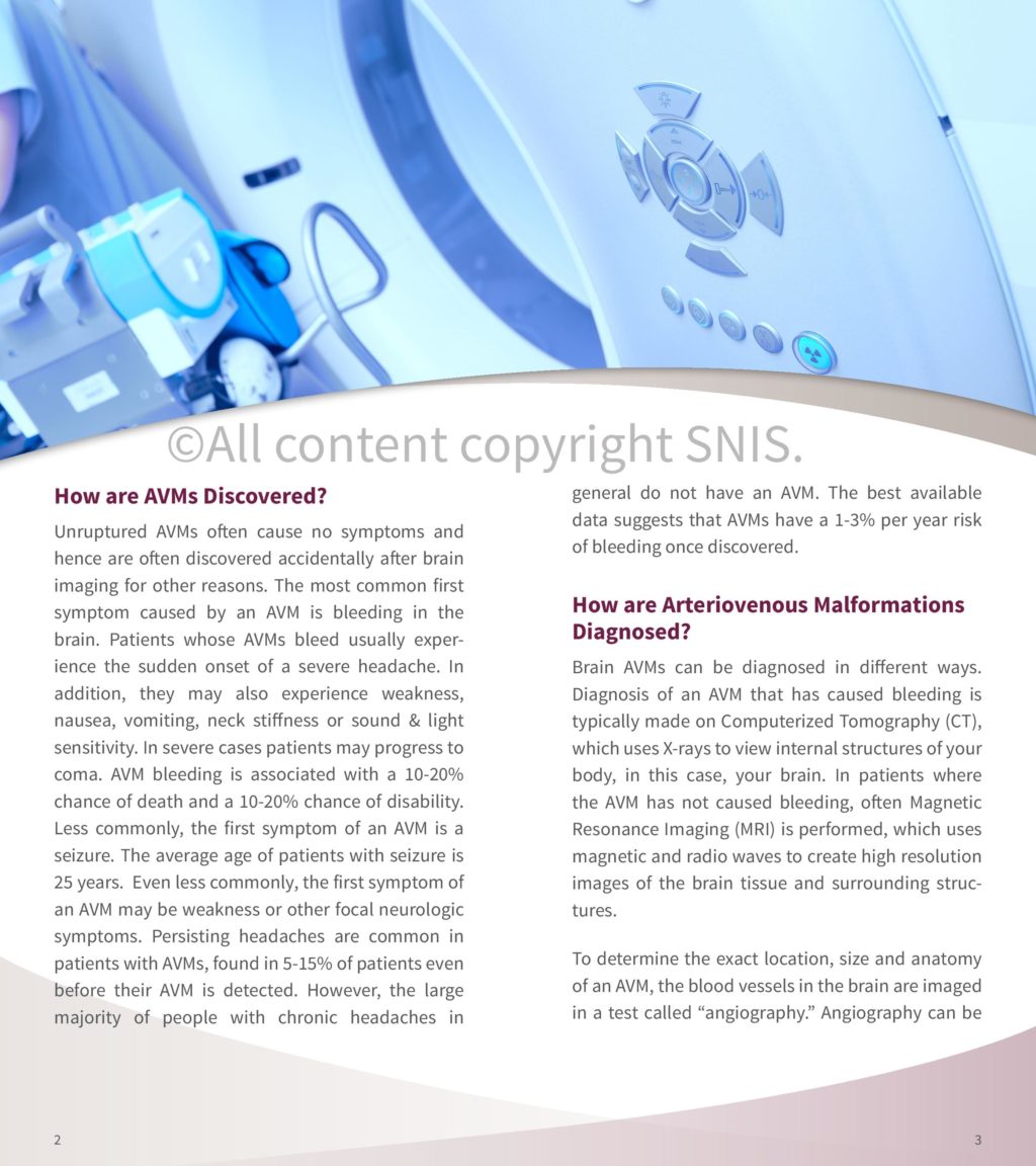 Brain Arteriovenous Malformations brochures (pack of 100) – SNIS